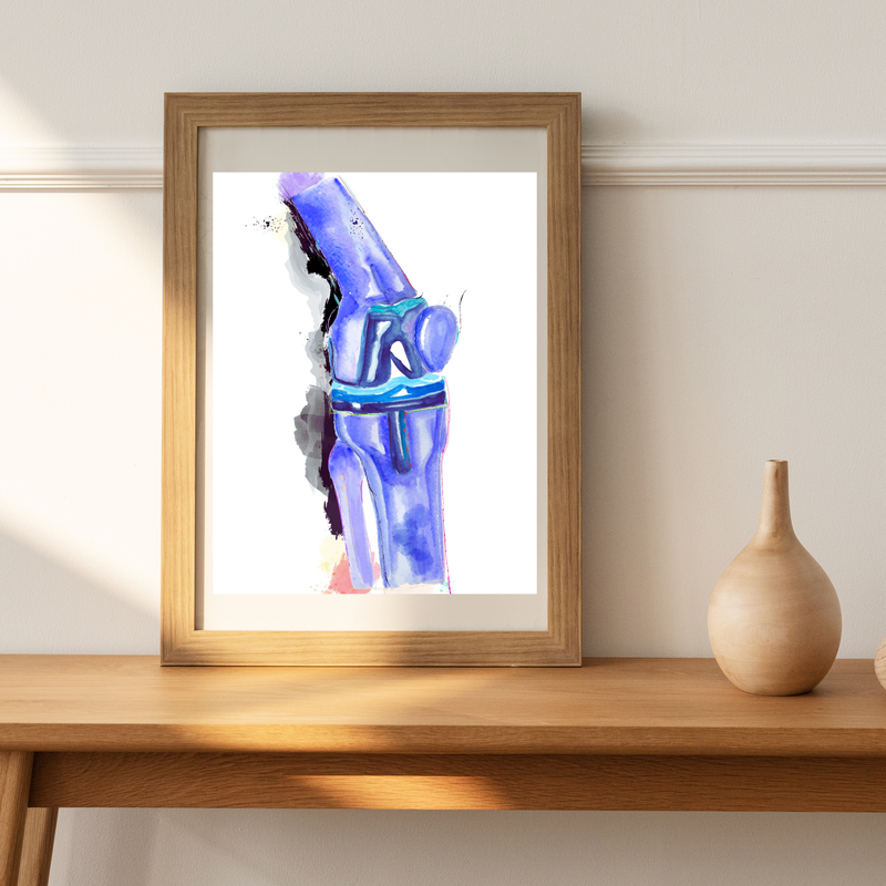 Knee Replacement Orthopedic Surgery Art Print - medpapers