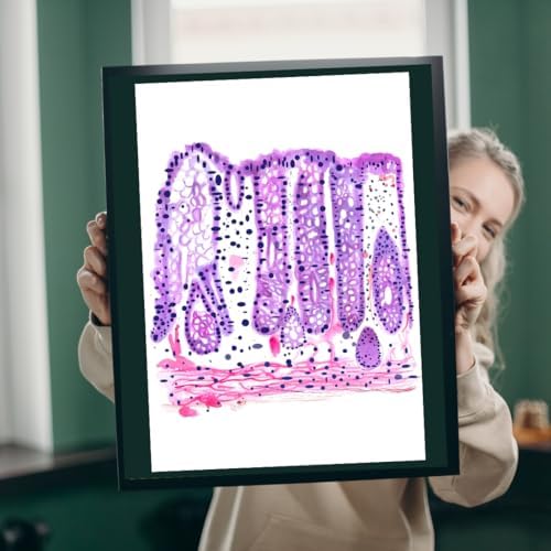 Colon Histology Art Print - medpapers