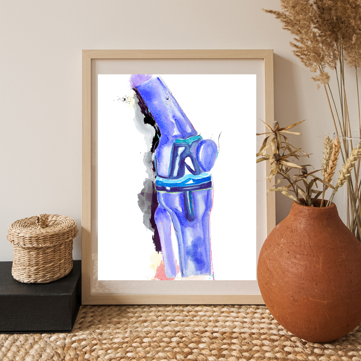 Knee Replacement Orthopedic Surgery Art Print - medpapers