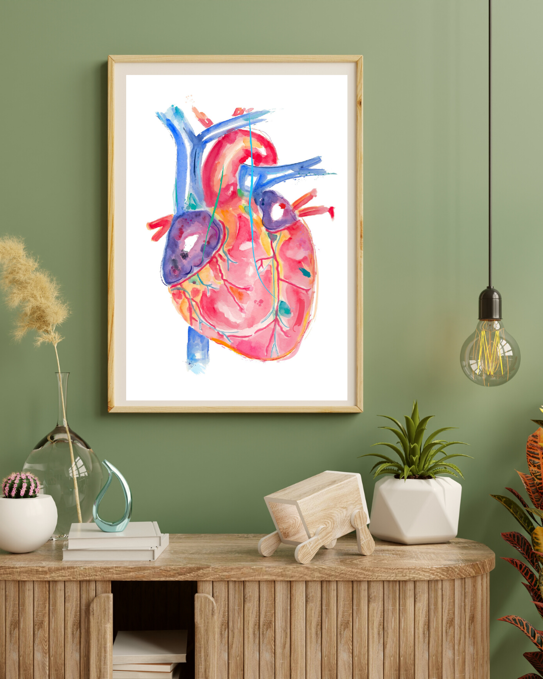 Coronary Artery Bypass Graft Surgery Art Print - medpapers