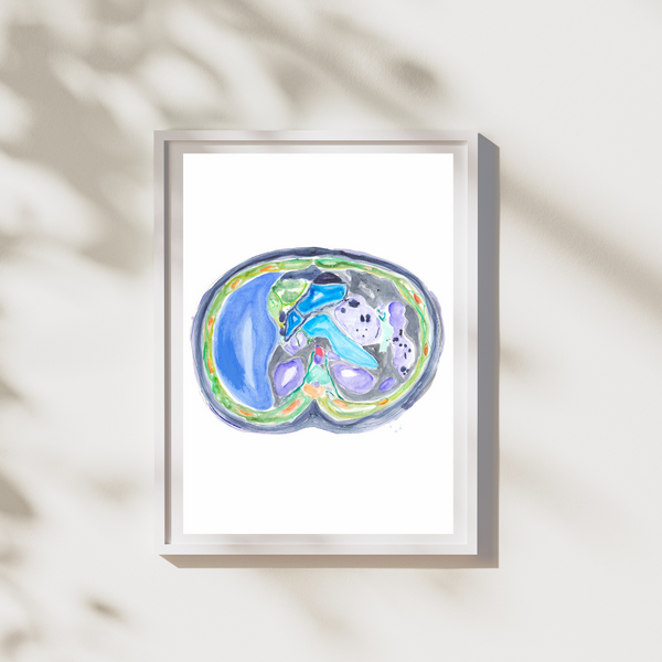 Abdominal CT Scan Cross Section Radiology Gastroenterology and Surgery ...