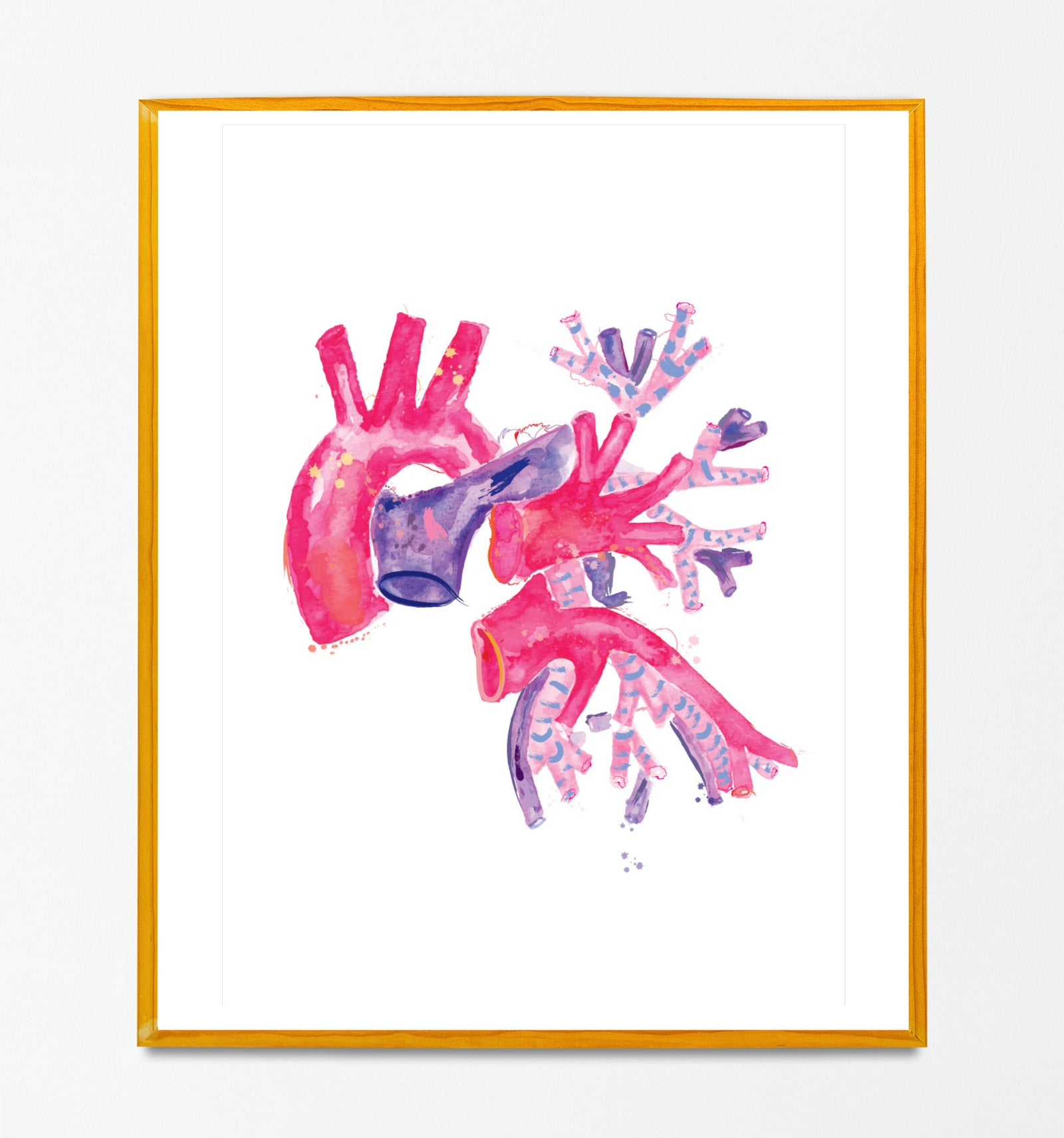 Vascular Art | Radiology | Angiology Tagged "cardiology office wall ...