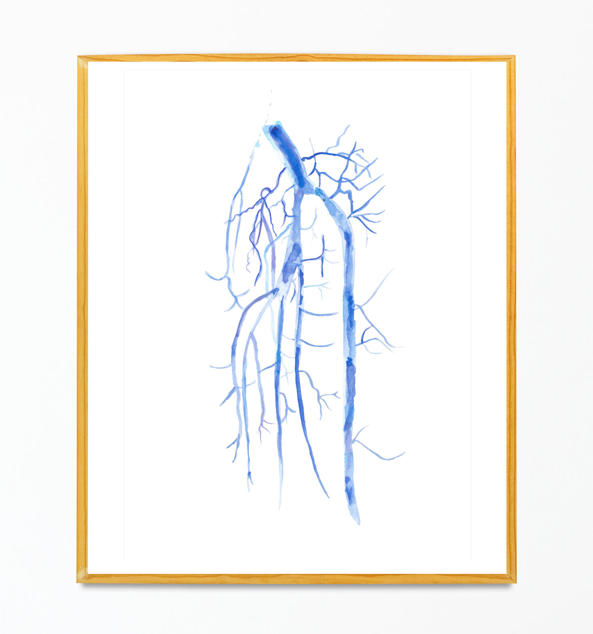 Vascular Art | Radiology | Angiology - medpapers