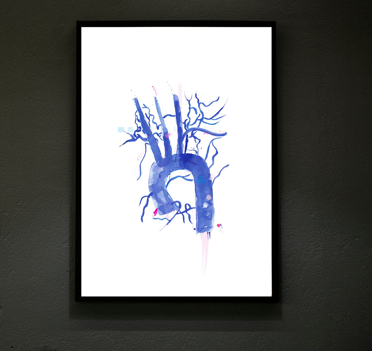 Aorta Anatomy, Cardiology Art Print, Interventional Radiology Wall Art ...
