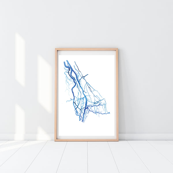 Upper Limb DSA, Vascular Surgery Radiology Art Print - medpapers